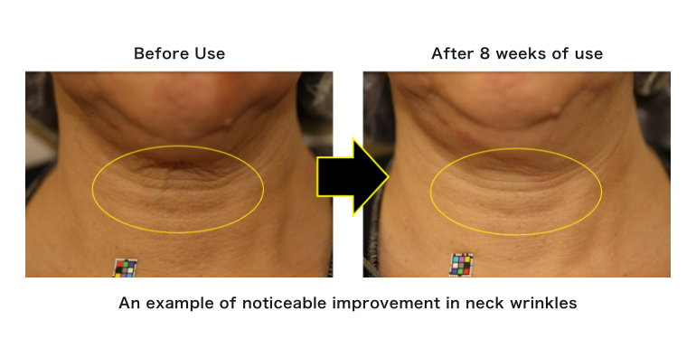 Skin Research | Research Areas | INNOVATION | Shiseido group website