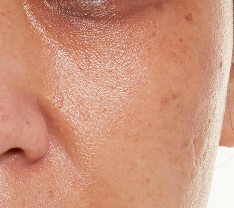 Examples of skin concerns we address | SHISEIDO LIFE QUALITY MAKEUP